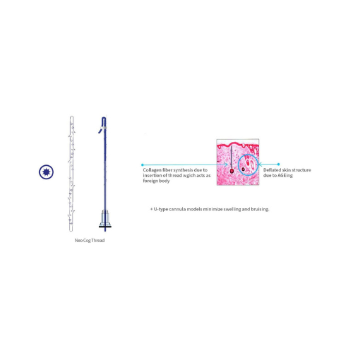 Neogenesis PDO Combi COG Thread 23G 60mm: Facial Precision