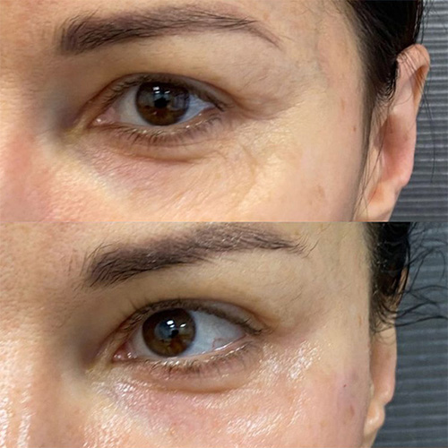 JuveLook are: For skin renewal: Improve skin elasticity and texture ...